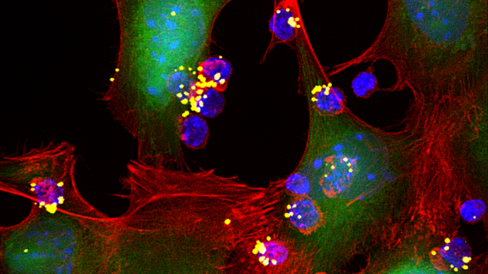 Spotlight: Boosted T cells | MIT - Massachusetts Institute of Technology