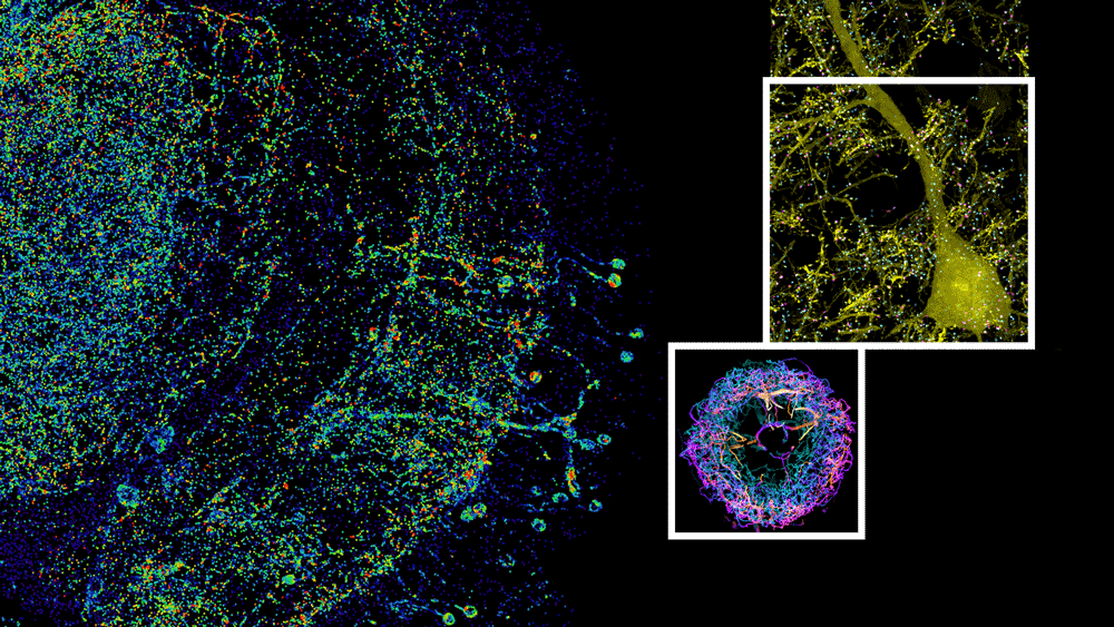 Spotlight: Mapping the brain | MIT - Massachusetts Institute of Technology