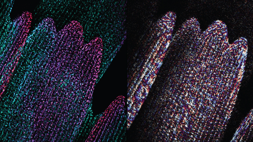 Spotlight: Peeking into a chrysalis | MIT - Massachusetts Institute of ...