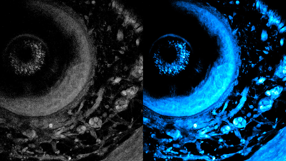 Spotlight: Deeper metabolic imaging | MIT - Massachusetts Institute of ...